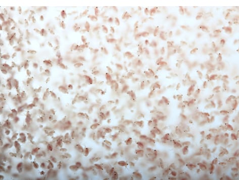 Raising Water Fleas as Live Food for Your Fish | Aquarium Cladocera | PetMD